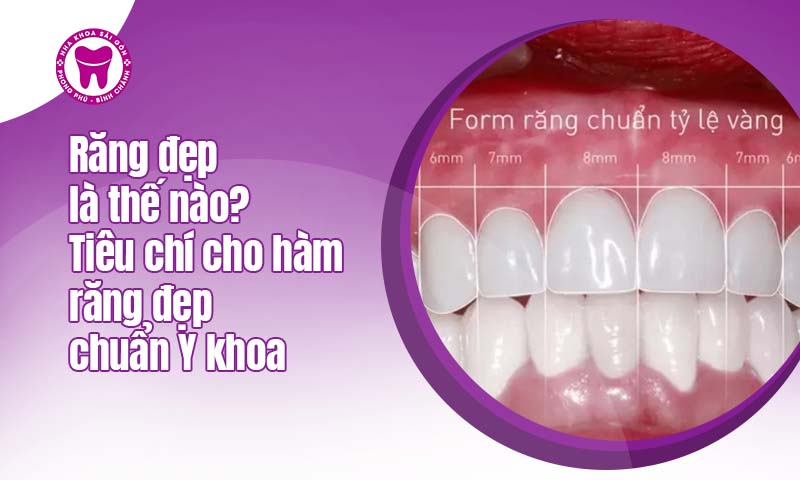Răng đẹp là thế nào? Tiêu chí cho hàm răng đẹp chuẩn Y khoa - Nha khoa ...