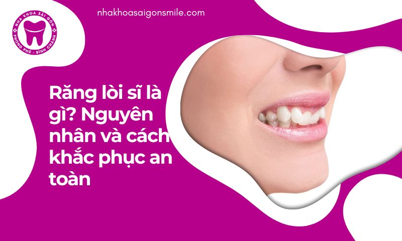 Răng lòi sĩ là gì? Nguyên nhân và cách khắc phục an toàn - Nha khoa Sài ...
