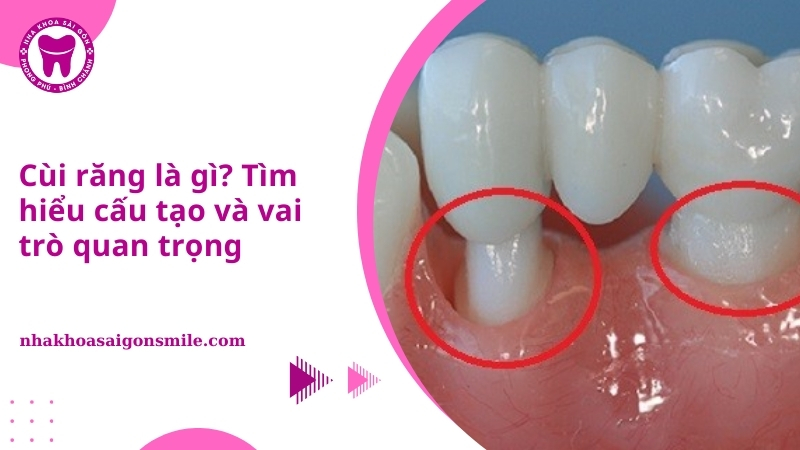 Cùi răng là gì? Tìm hiểu cấu tạo và vai trò quan trọng - Nha khoa Sài ...